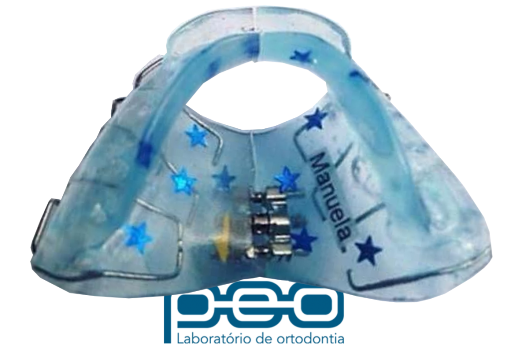 Aparelhos com Figuras – PEO – Prótese Especializada em Ortodontia